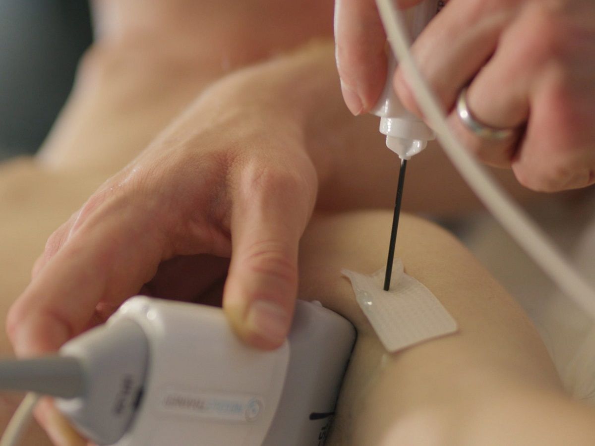 Intelligent Ultrasound Group Launches NeedleTrainer 2 | Halldale Group