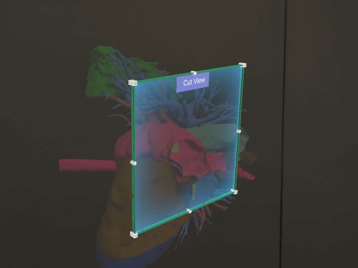 GigXR Debuts 3D Medical Imagery Training Using Holograms | Halldale Group